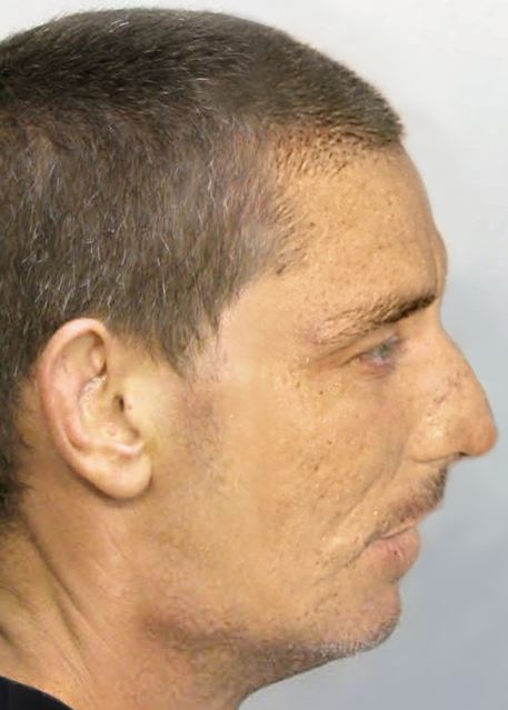 Florida Missing Person Flyer